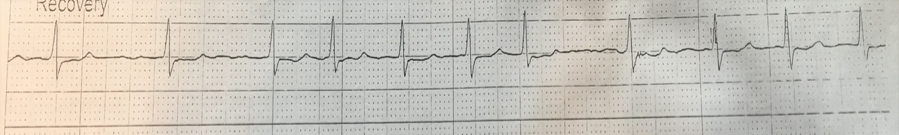 Question 10 Application of EKG in the Clinical Setting PhysicalTherapy ...
