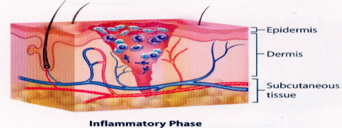 Wound Care: Basic Concepts and Treatments - Article 3930